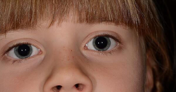 Kell vagy sem? Vita az orrmandula körül - Életforma.hu